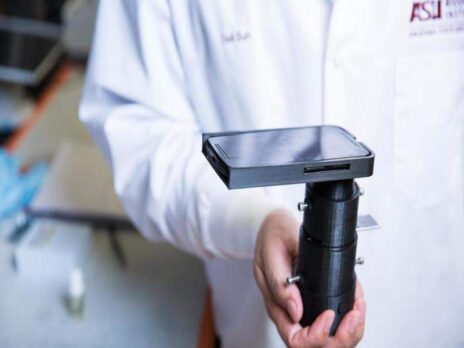 US researchers develop mobile phone adaptation of microscope - Medical ...