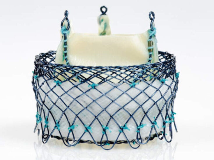 HLT begins enrolment in clinical trial of Meridian valve and Pathfinder ...