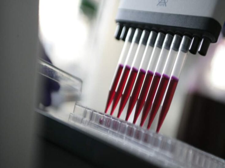 BEST 3 trial for Cambridge University's Cytosponge test begins in UK ...