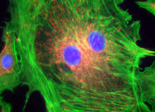 OmniCure® - Medical Device Network