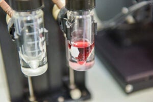 Russian researchers develop test strip to diagnose heart attack ...