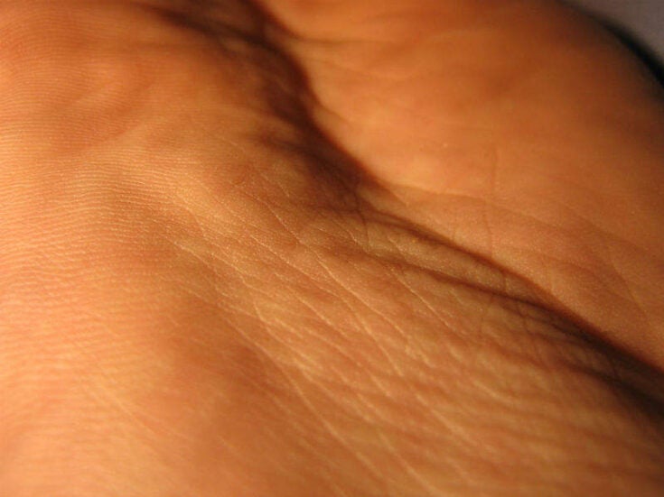 3D bioprinting recreates human skin pigmentation - Medical Device Network