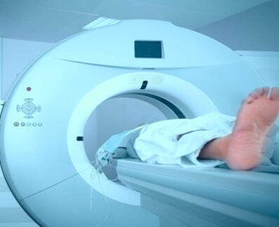 PET/CT tests for calcium in coronary arteries can predict heart attack ...