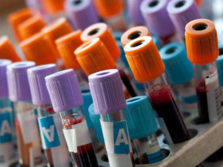 UK researchers to develop new commercial blood test for meningitis ...