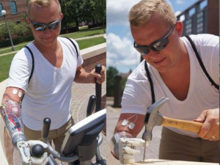 Algorithm creates reliable sensory feedback for prosthetic arm users ...