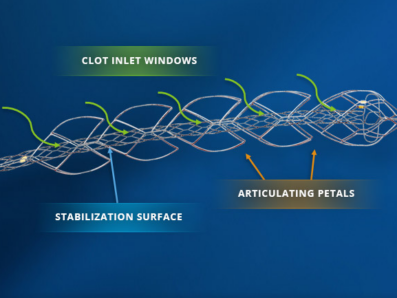 Clot removing device clot has positive results for stoke patients ...
