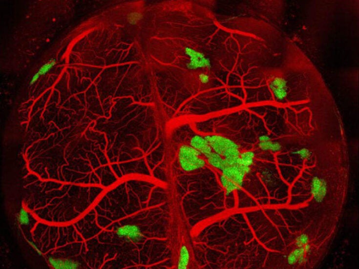 Bioengineered human pancreatic cells successfully treat diabetic mice ...