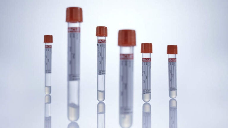 New Serum Tube by Greiner Bio-One for Quick Analysis - Medical Device ...