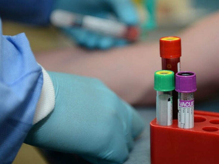 Blood test could determine best timing to administer drugs - Medical ...