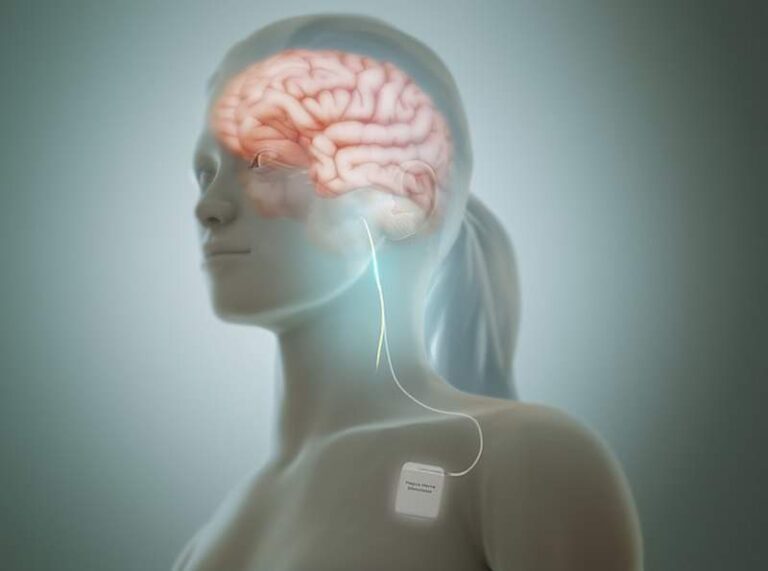 LivaNova initiates Vitaria System study to treat heart failure