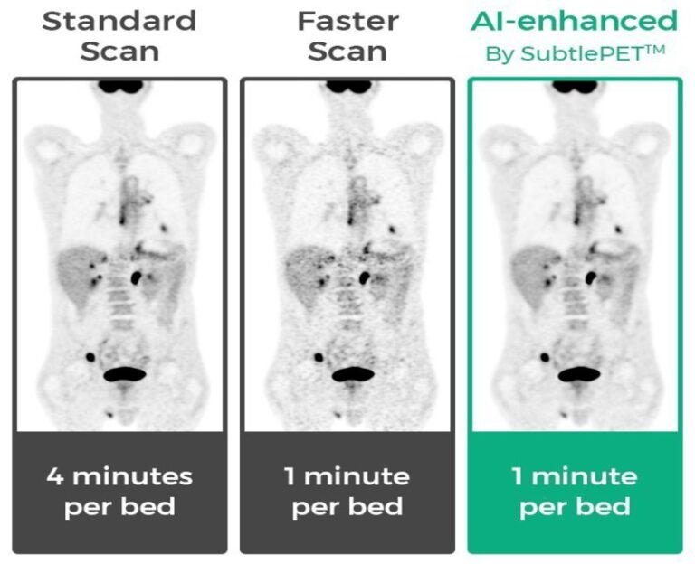 Subtle Medical gets FDA and CE-Mark clearances for imaging technology