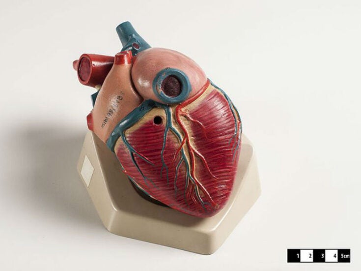 Tara Biosystems publishes Biowire II heart-on-a-chip platform research