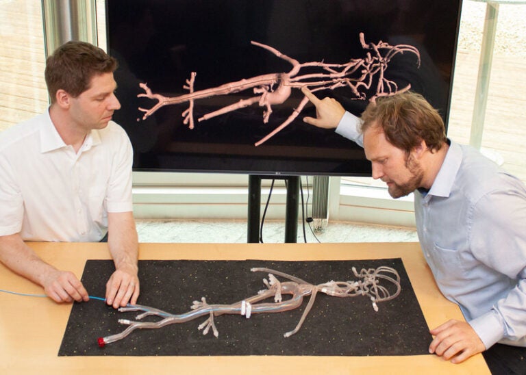 German researchers develop Intelligent Catheter Navigation system