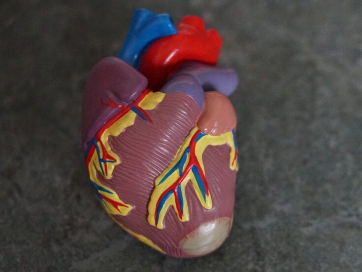 Neovasc plans to seek HDE approval for Reducer device in US