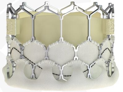 MyVal transcatheter heart valve reports positive trial results