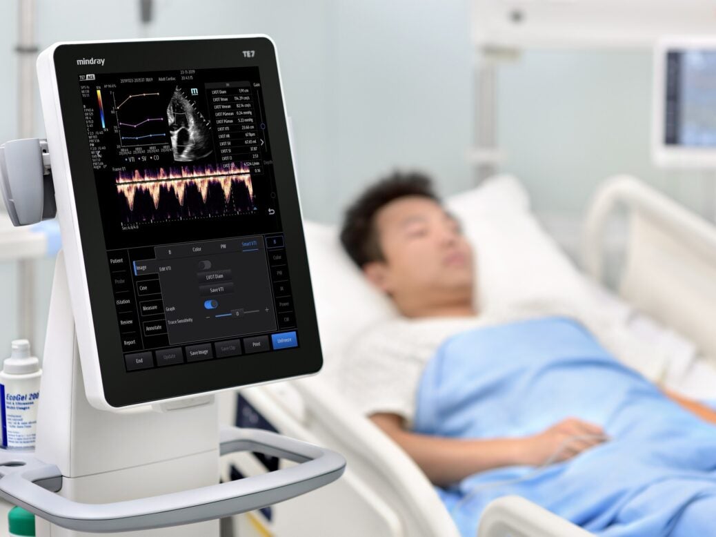 Mindray Medical introduces new point-of-care ultrasound system