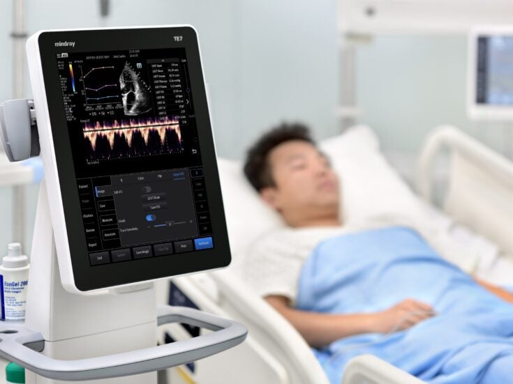 Mindray Medical introduces new point-of-care ultrasound system