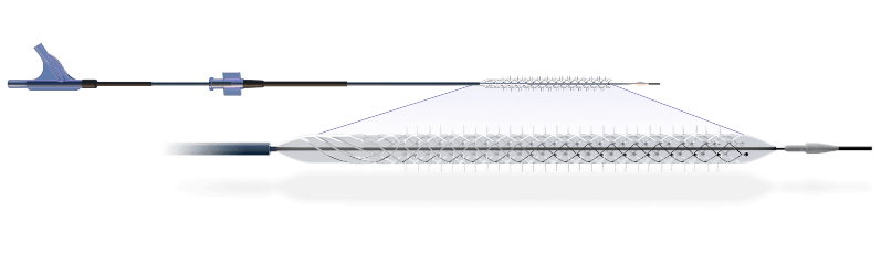 Reflow obtains breakthrough designation for temporary spur stent system