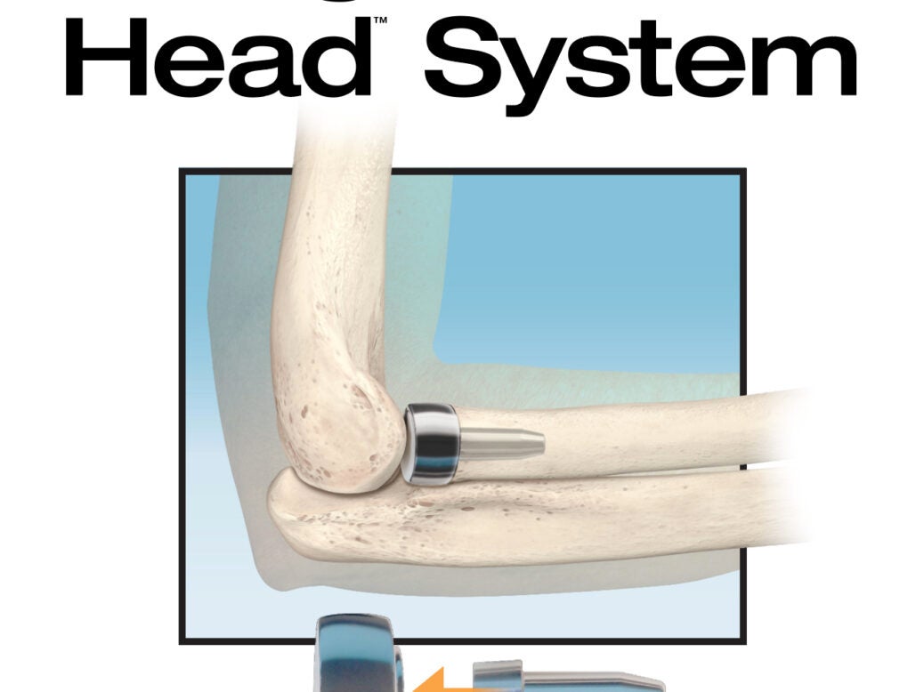 In2Bones launches Avenger Radial Head Prosthesis System in US