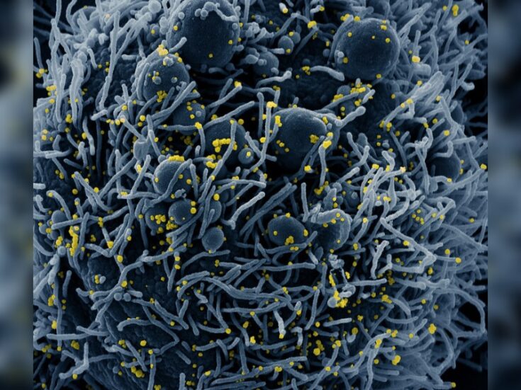 FDA grants EUA for ALung’s respiratory system for Covid-19 treatment