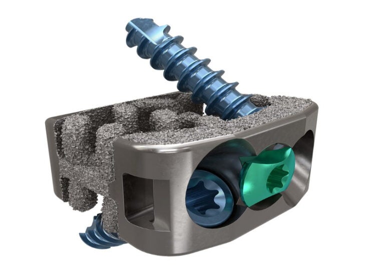 Camber Spine obtains FDA clearance for two anterior cervical products