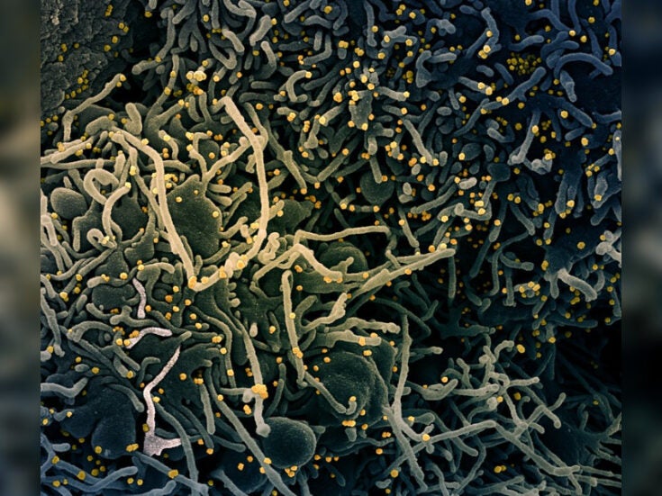 Abbott’s Covid-19 test secures EUA for use on Alinity System