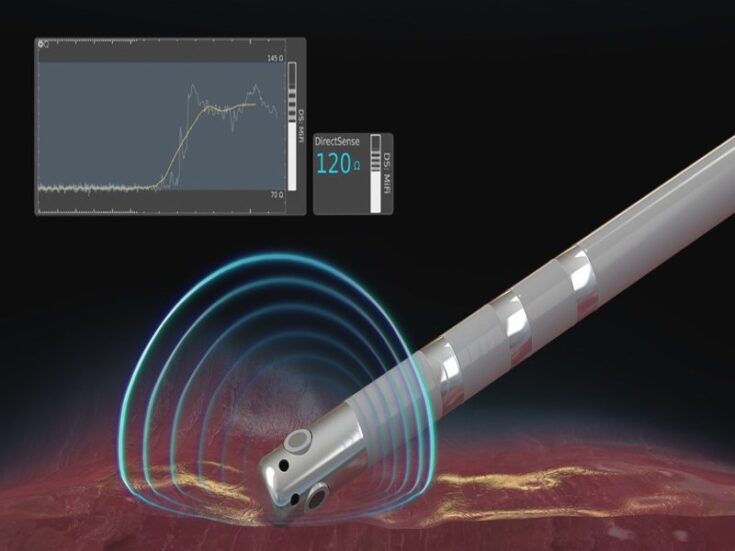 Boston Scientific launches tool to monitor radiofrequency energy