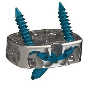 4WEB Medical receives FDA clearance for spine interbody implant