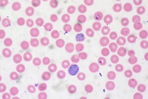 Sysmex receives marketing approval for Malaria diagnostic device in Japan
