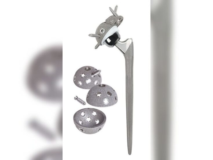 Smith+Nephew to launch revision total hip arthroplasty system in China