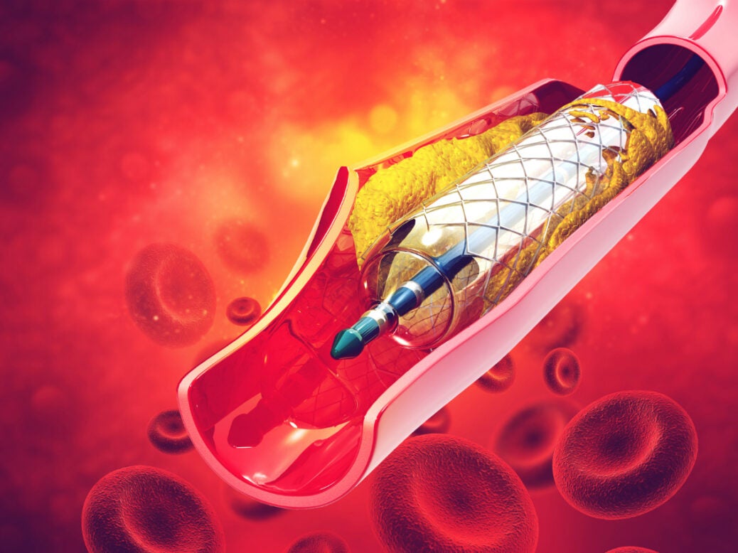 CeloNova reports late-breaking evidence from COBRA-REDUCE trial