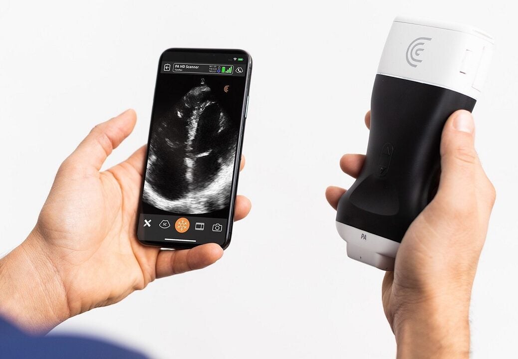 Clarius Phased Array (PA) HD Ultrasound Scanner, Canada