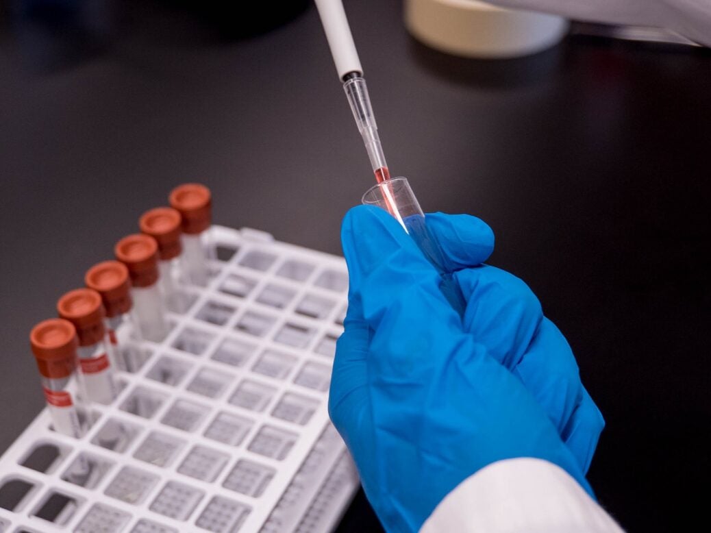 Ethos unveils SARS-CoV-2 test to detect emerging mutations