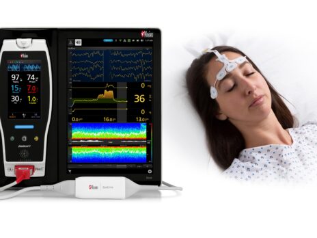 Masimo’s SedLine parameters predict outcomes post-cardiac arrest