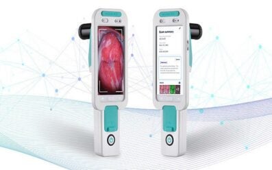 MobileODT launches VisualCheck algorithm for screening cervical cancer