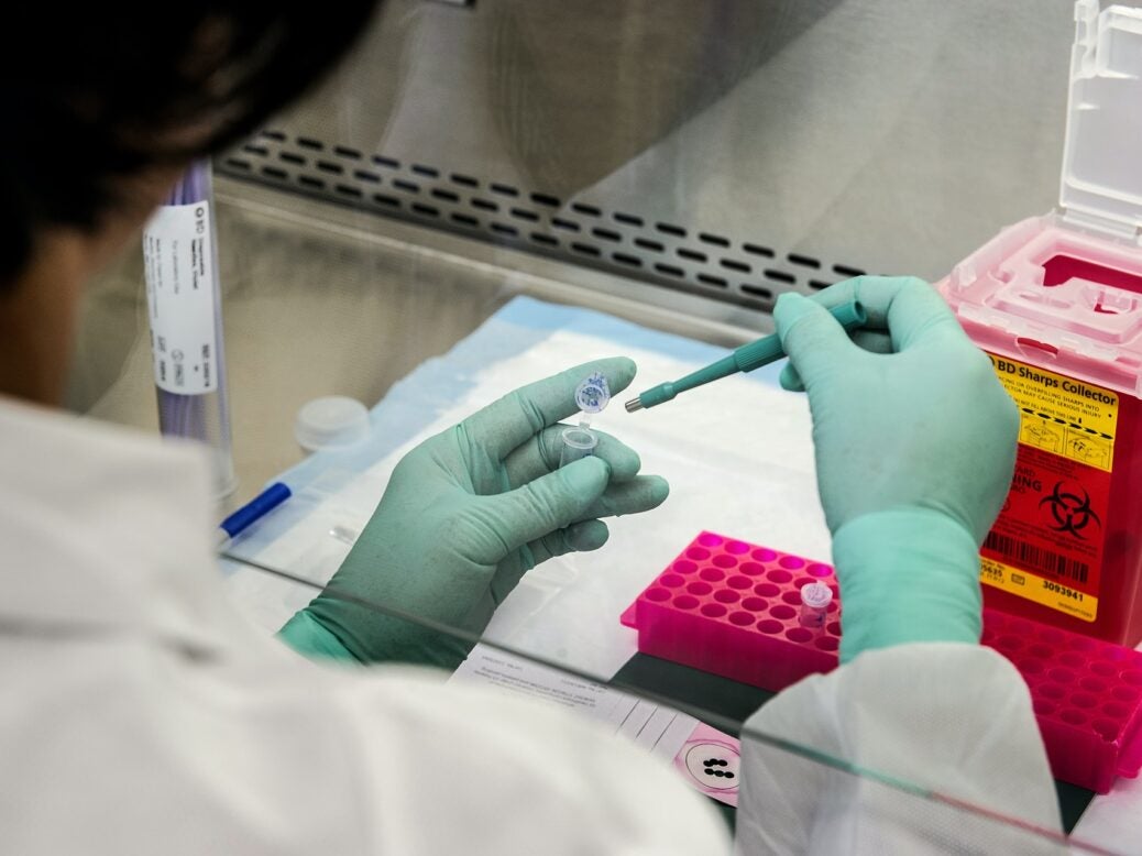 FDA grants 510(k) clearance for bioMérieux’s Vitek MS Prime