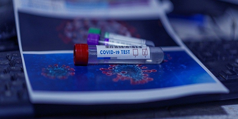Eurobio Scientific introduces new Covid-19 RT-PCR test