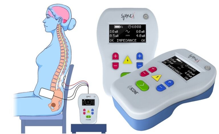 SpineX begins participant enrolment in clinical trial of SCONE Device