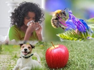 Bracco Diagnostics launches CardioGen-82 infusion system