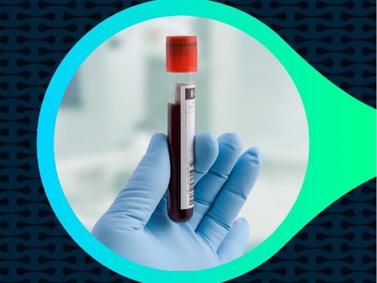 FDA grants 510(k) clearance for latest version of Organon’s Jada system