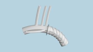 Terumo announces first Thoraflex device implant in US