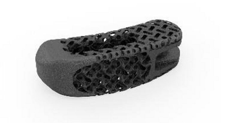 SeaSpine launches 3D-printed lumbar interbody system