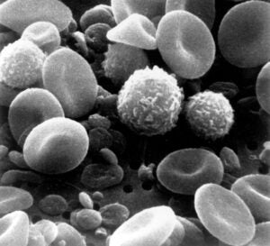 Leuko raises Series A funds to validate WBC monitoring solution