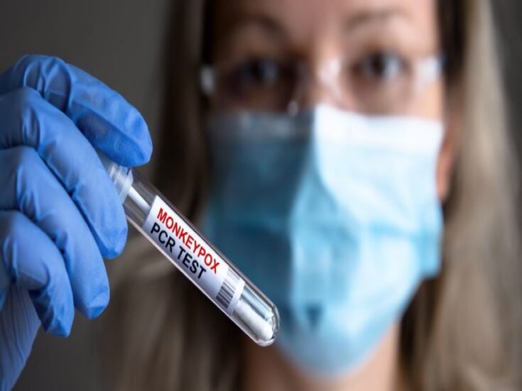 US BioTek Laboratories rolls out diagnostic testing for Monkeypox