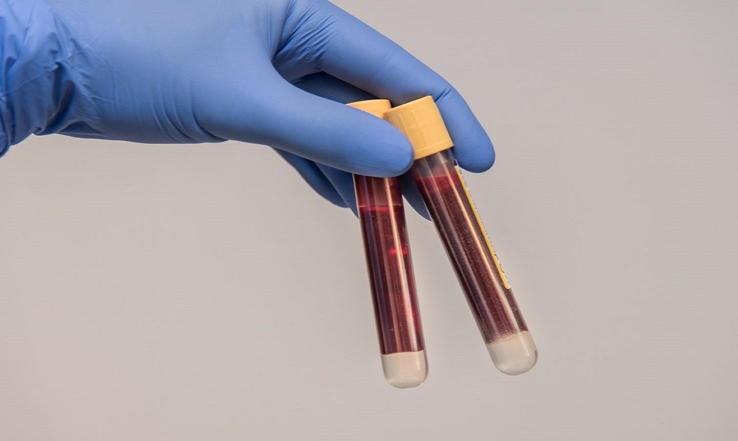 C2N Diagnostics Launches New PrecivityAD2 Blood Test C2N Diagnostics Launches New PrecivityAD2 Blood Test