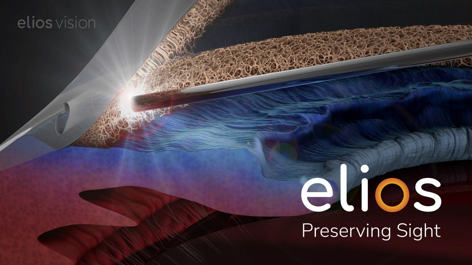 Medical Device Network Excellence Awards 2023: Elios Vision