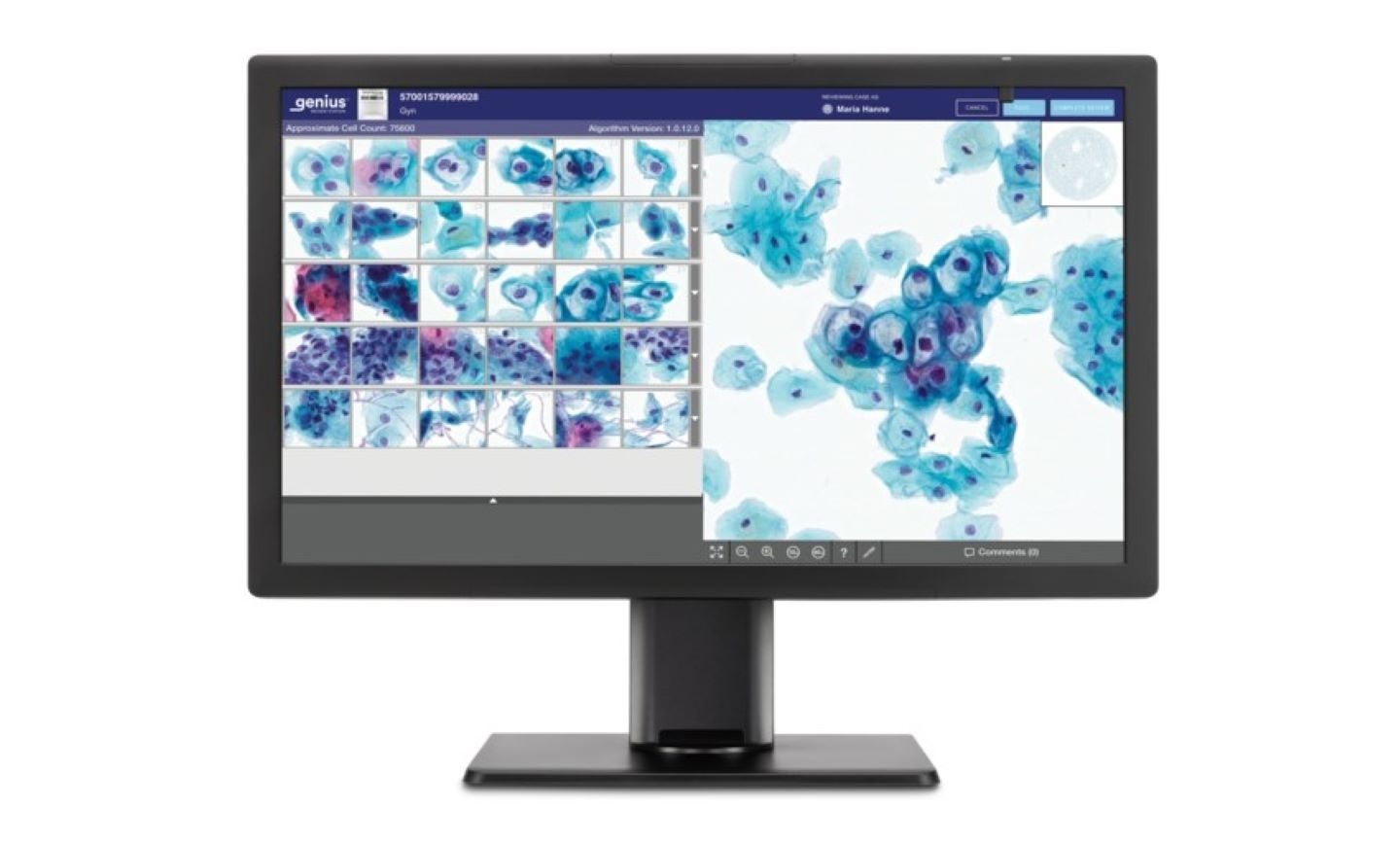 FDA grants clearance for Hologic's cancer screening system