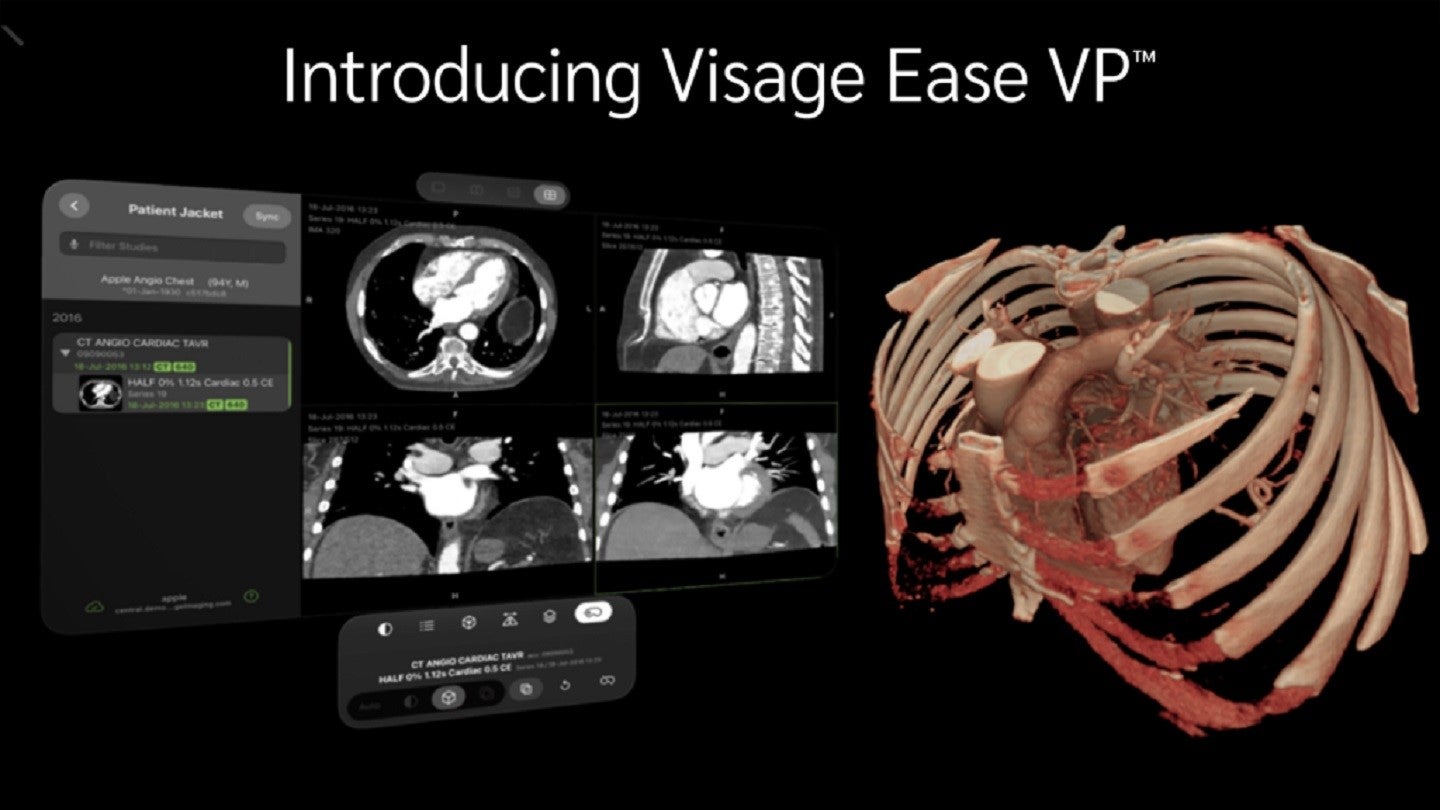 Visage launches diagnostic imaging platform for Apple Vision Pron