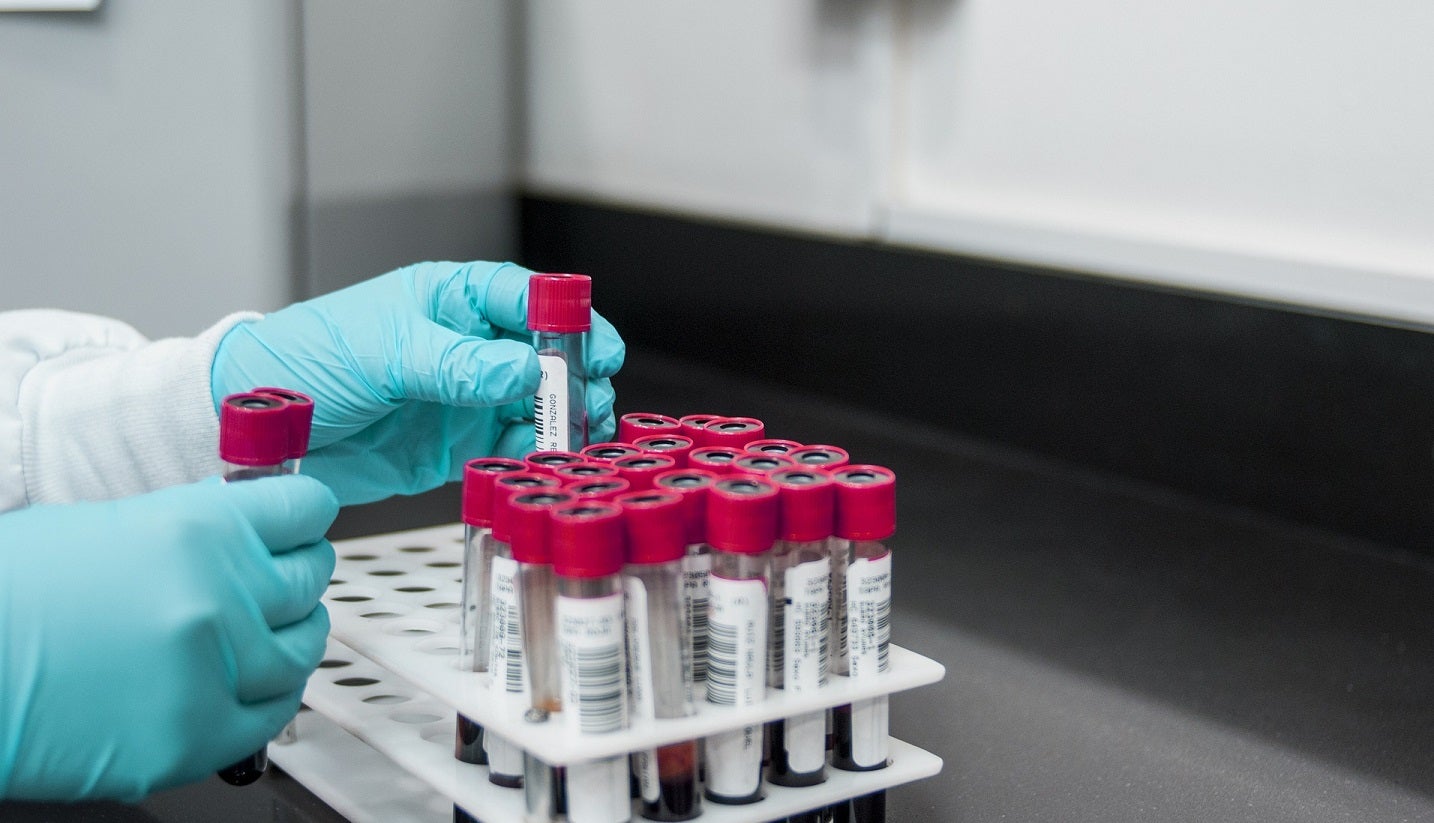 Selux’s PBC Separator obtains US FDA 510(k) clearance