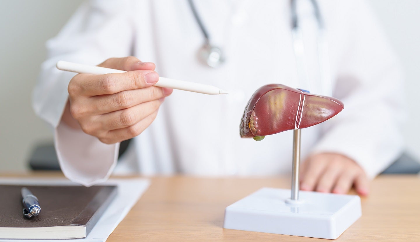 ENDRA installs first TAEUS liver system at London hospital